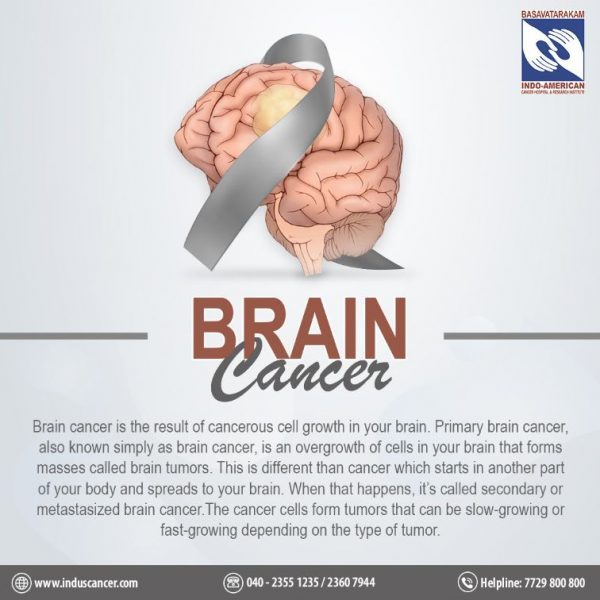 Understanding Brain Cancer: Causes, Symptoms, and Treatment ...
