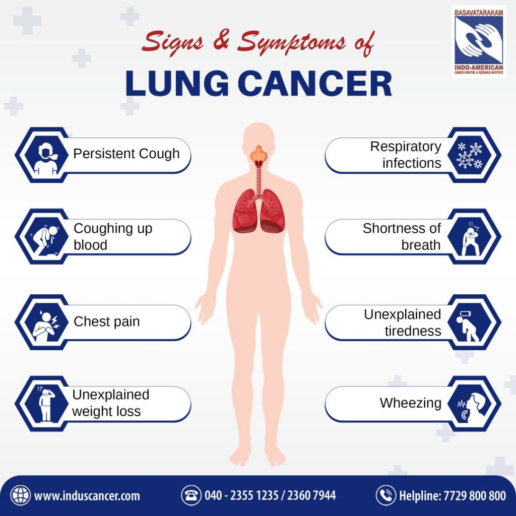 Lung Cancer: Understanding, Preventing, and Conquering the Unknown ...