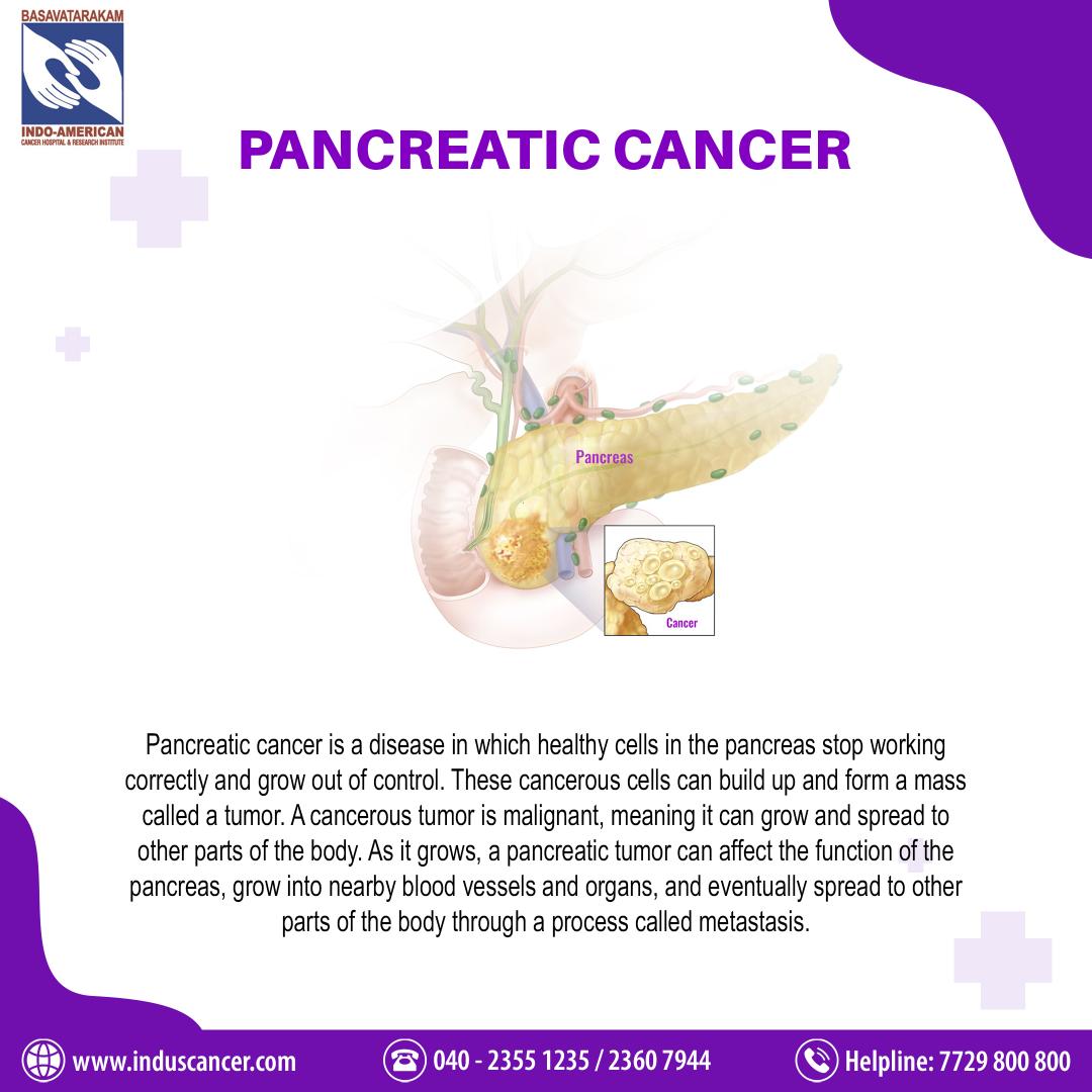 Pancreatic cancer - Symptoms and causes - Basavatarakam Cancer Hospital ...